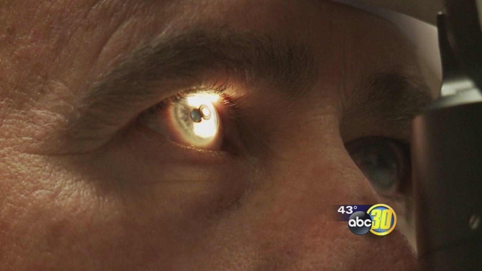 KAMRA Corneal Inlay Gets CJ Back on the Race Track - ABC30 Fresno