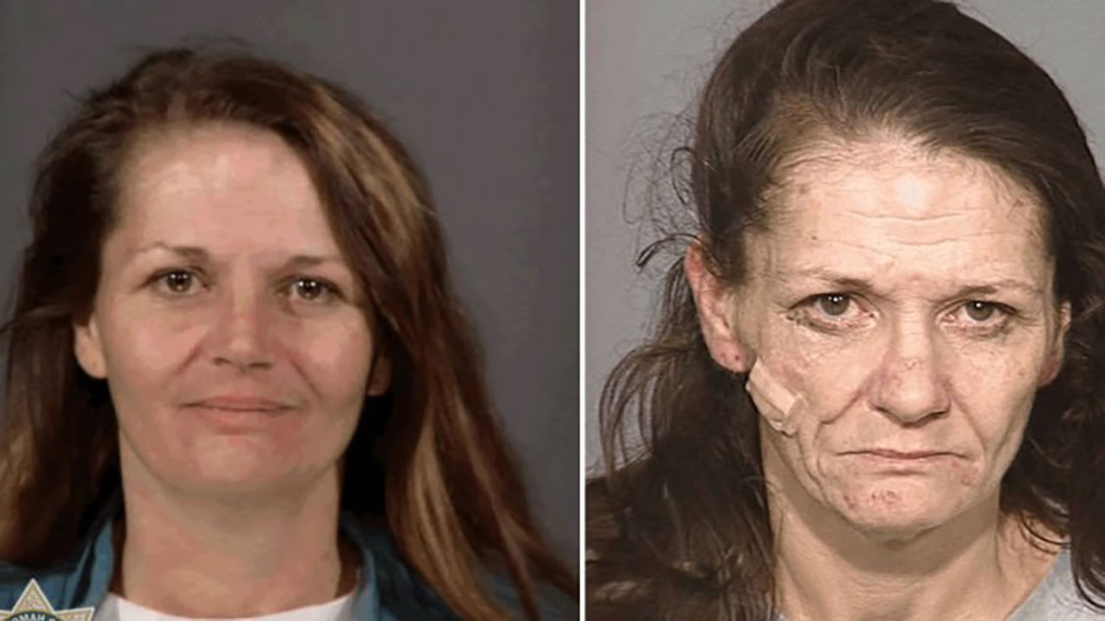 PHOTOS: You won't want to try meth after you see what it does to your ...
