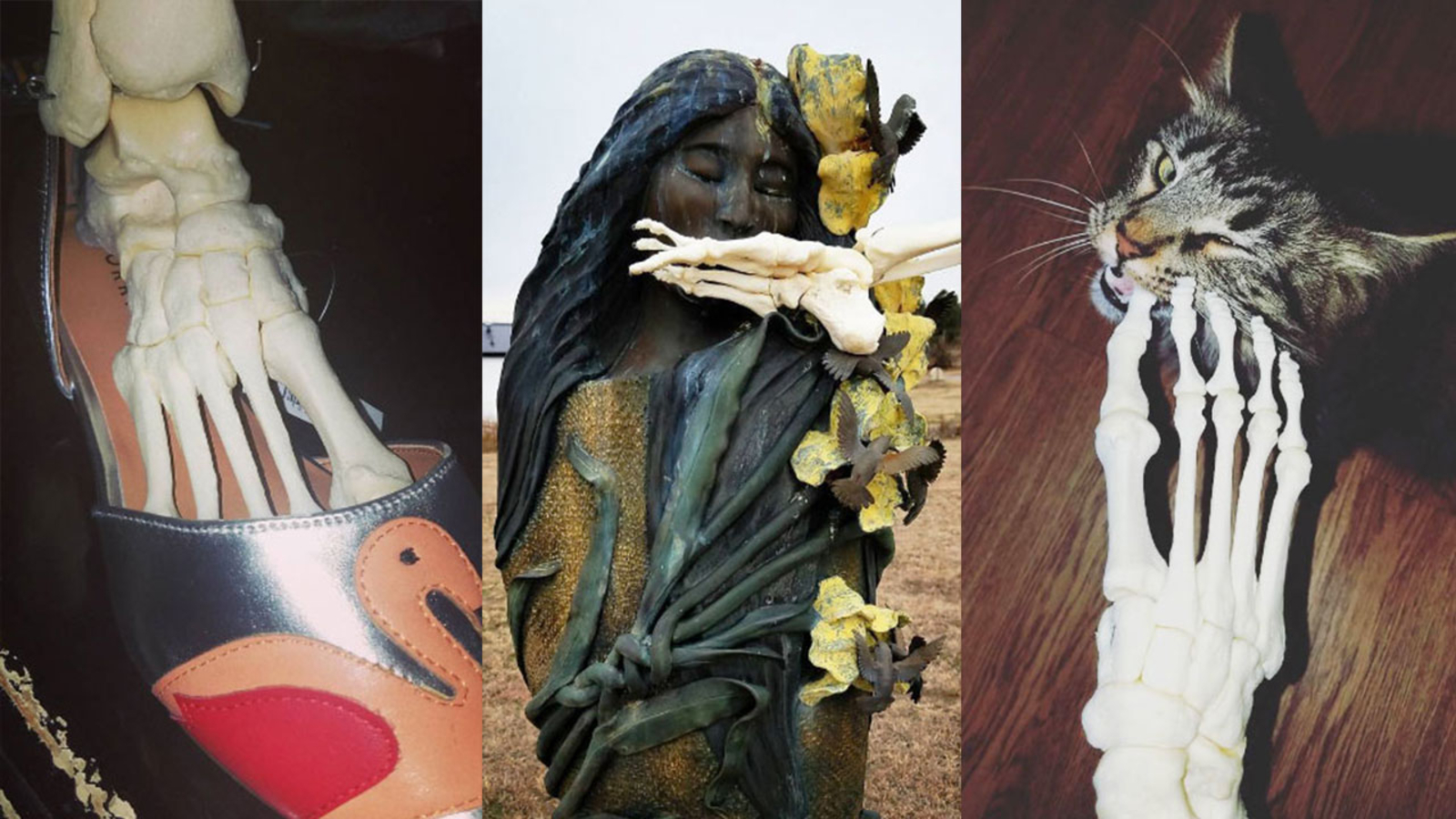 Cancer survivor's amputated foot is Instagram's newest star - ABC7 New York