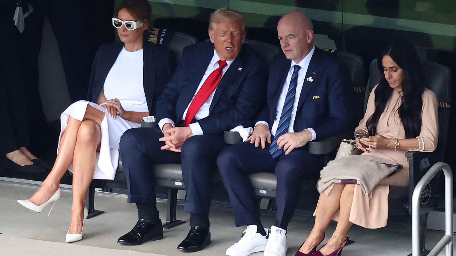 Trump diagnosed with chronic venous insufficiency after undergoing ...