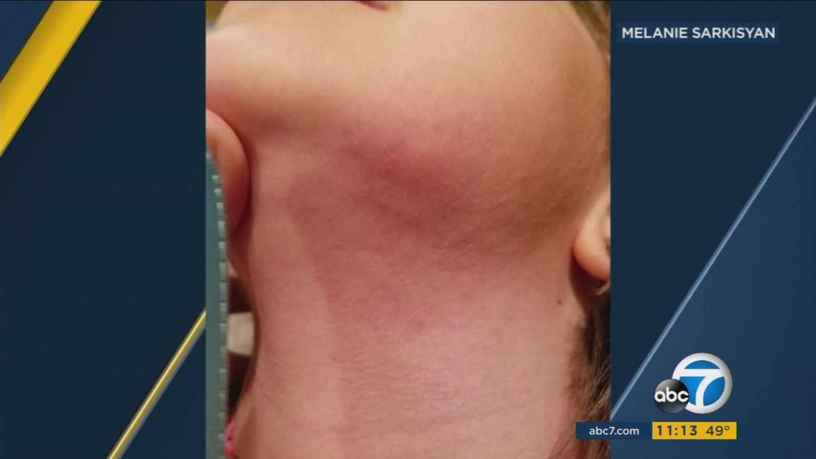 Porter Ranch residents claim new gas smell from storage field causing ...