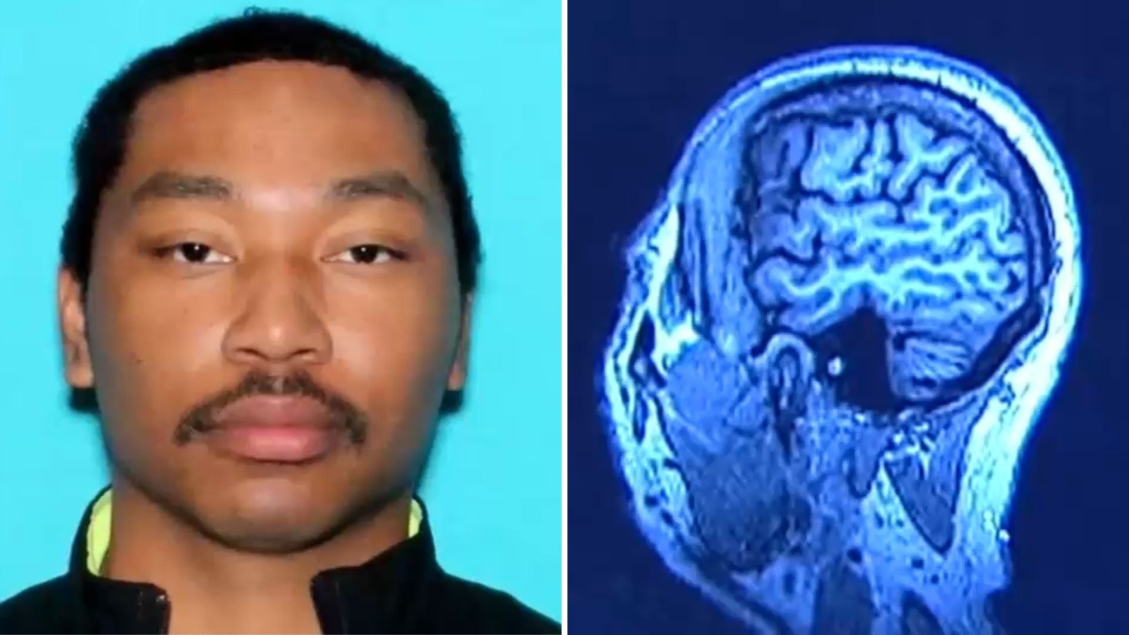 What is CTE, the brain disease Midtown mass shooting suspect Shane ...