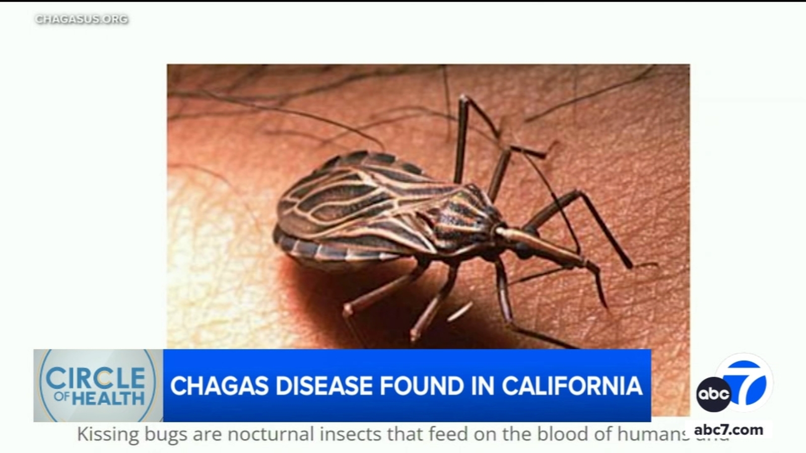 Chagas disease, parasitic infection from 'kissing bugs,' found in SoCal ...