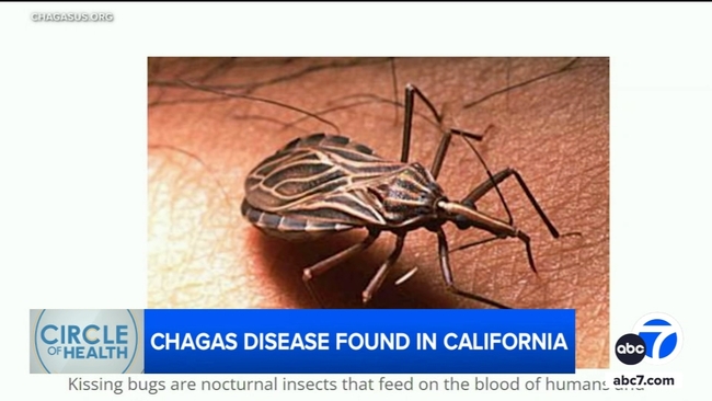 CDC warns of spread of Chagas disease from 'kissing bugs,' says it could become endemic illness ...