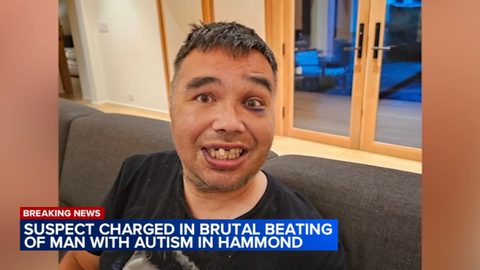 Keshaun Brooks charged in brutal Hessville Park beating of Scott ...