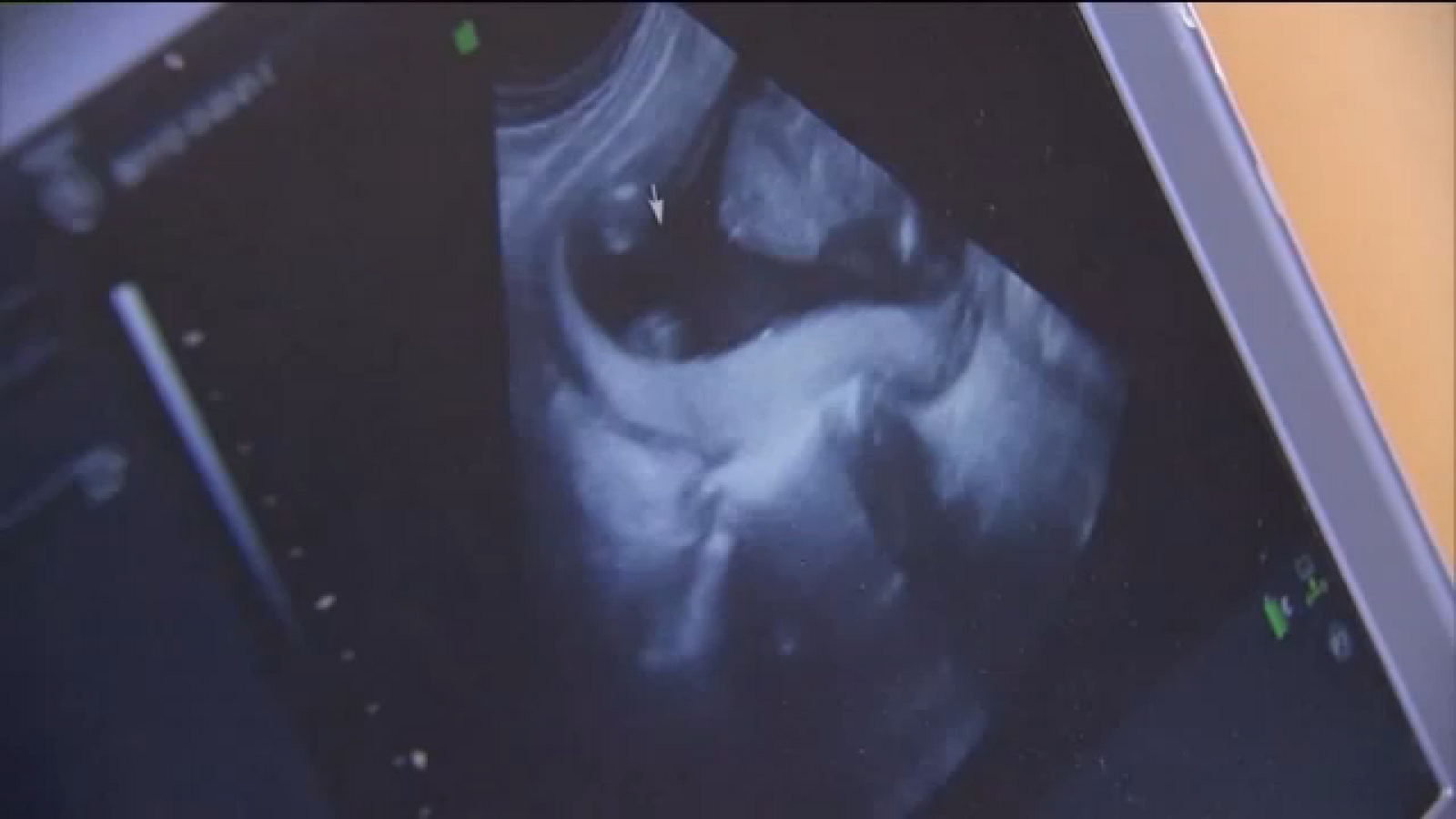 Texas lawmakers approve letting private citizens sue abortion pill ...