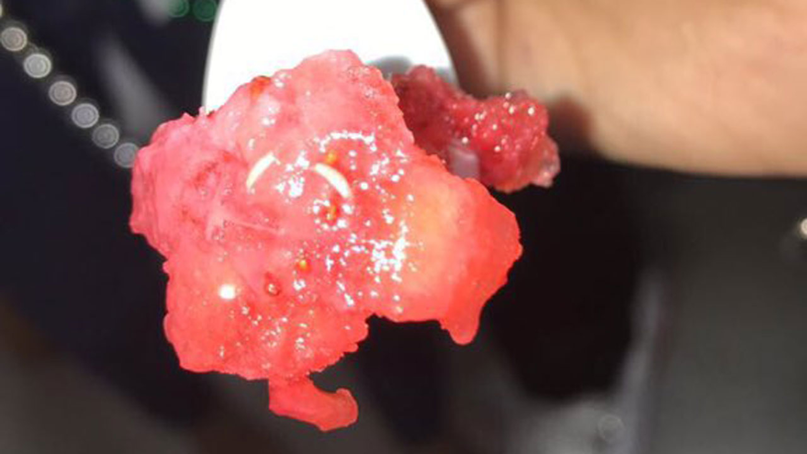 Maggot-infested strawberries served to Cy-Fair ISD students - ABC13 Houston