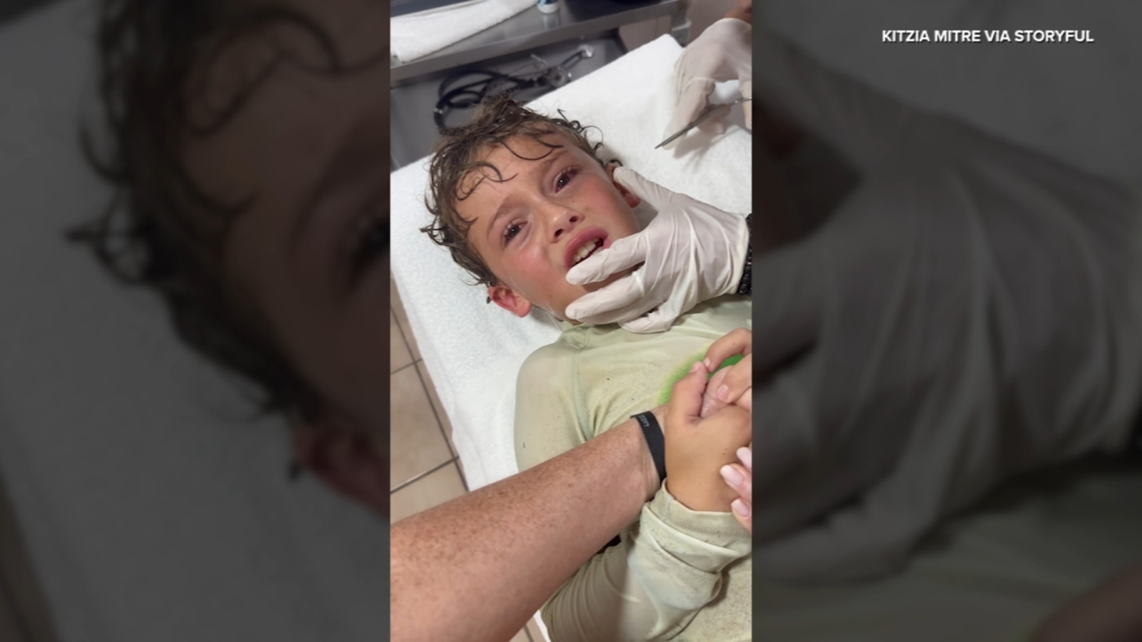 Video shows live crab removed from boy's ear while on vacation in ...