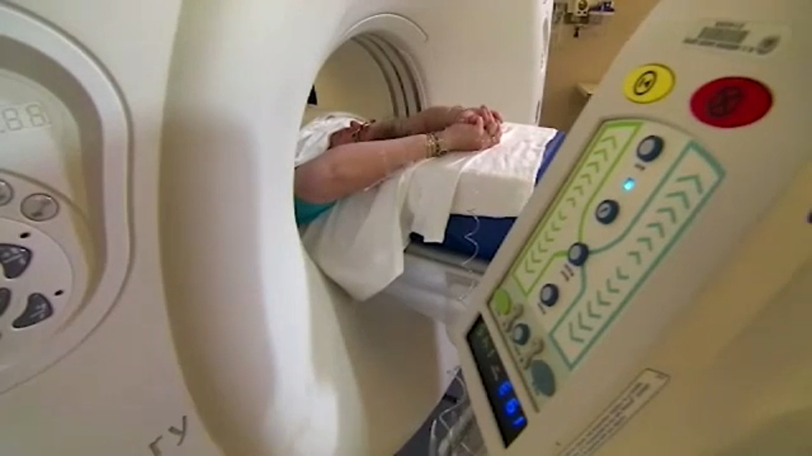 UNC Lineberger leading new trial for anaplastic thyroid cancer - ABC11 ...