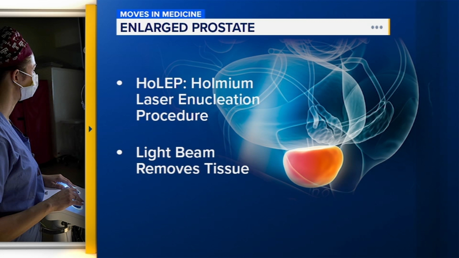 Team approach remedies two prostate issues together | Moves in Medicine ...