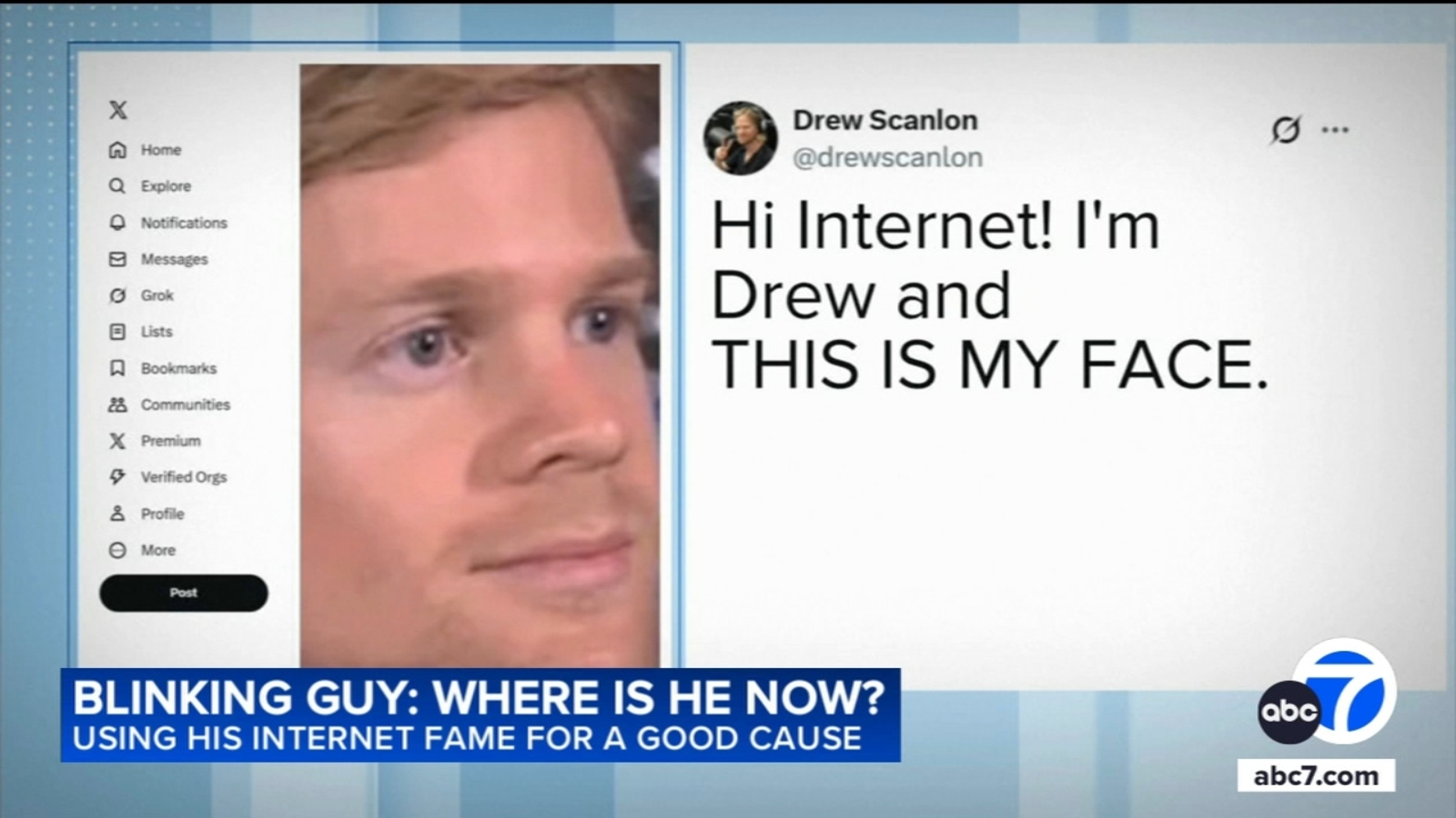 Blinking Guy meme: Drew Scanlon raises money for annual bike race ...