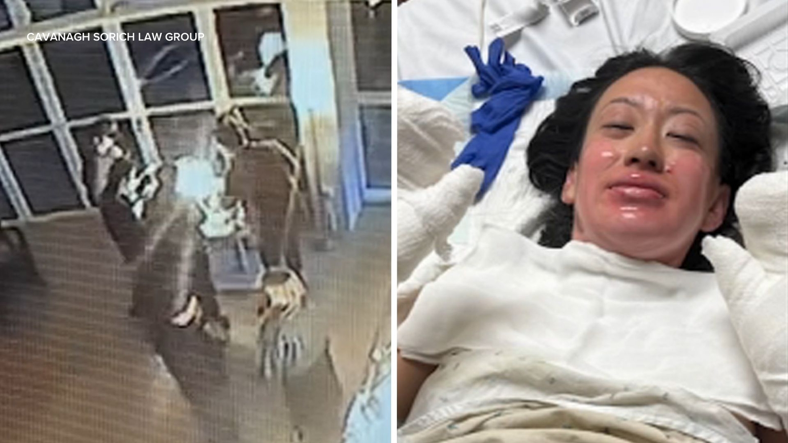 Navy Pier lawsuit: Kira Bond of New York seriously injured by s'mores fire sues Offshore Rooftop ...