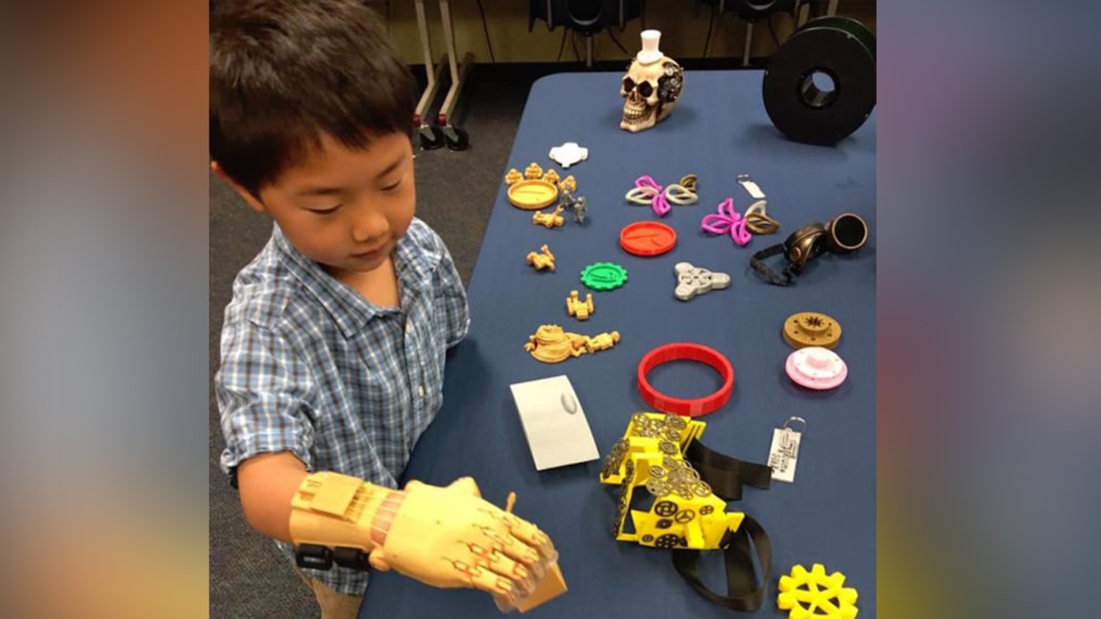 This 10th Grader Built a Prosthetic Hand for a 6-Year-Old Boy Born with ...