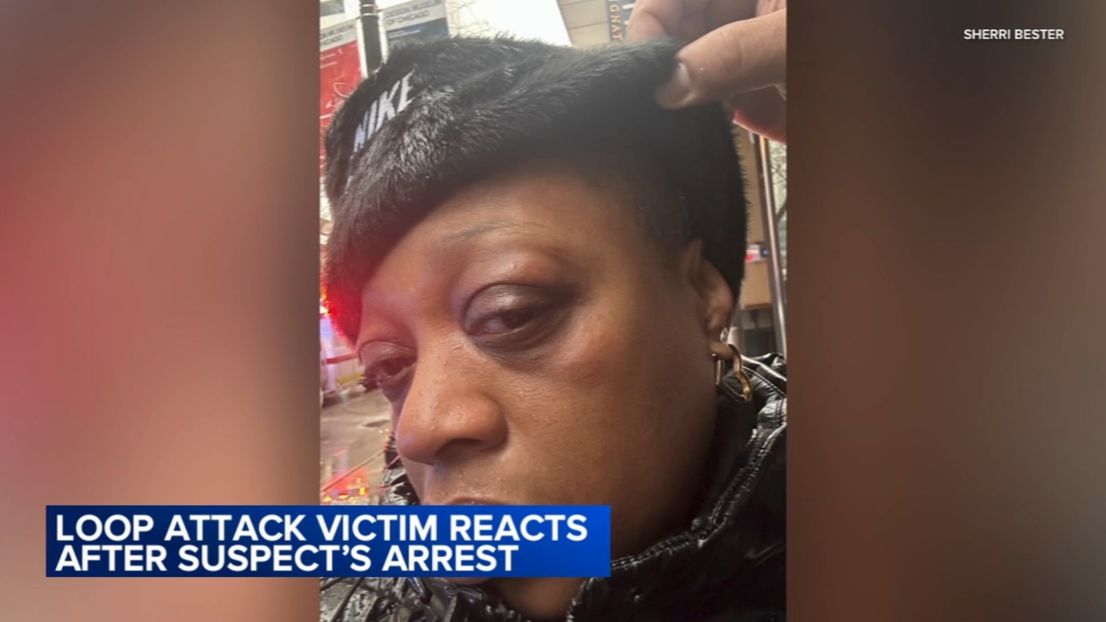 Loop puncher Chicago news: Marlon Miller ordered detained after alleged ...