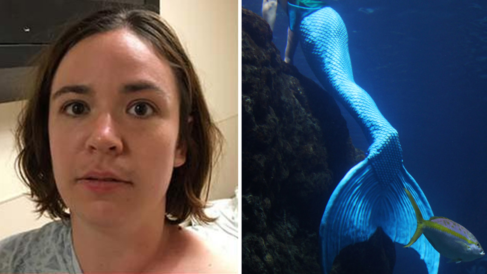 Woman with webbed toes claiming to be mermaid found wandering ...