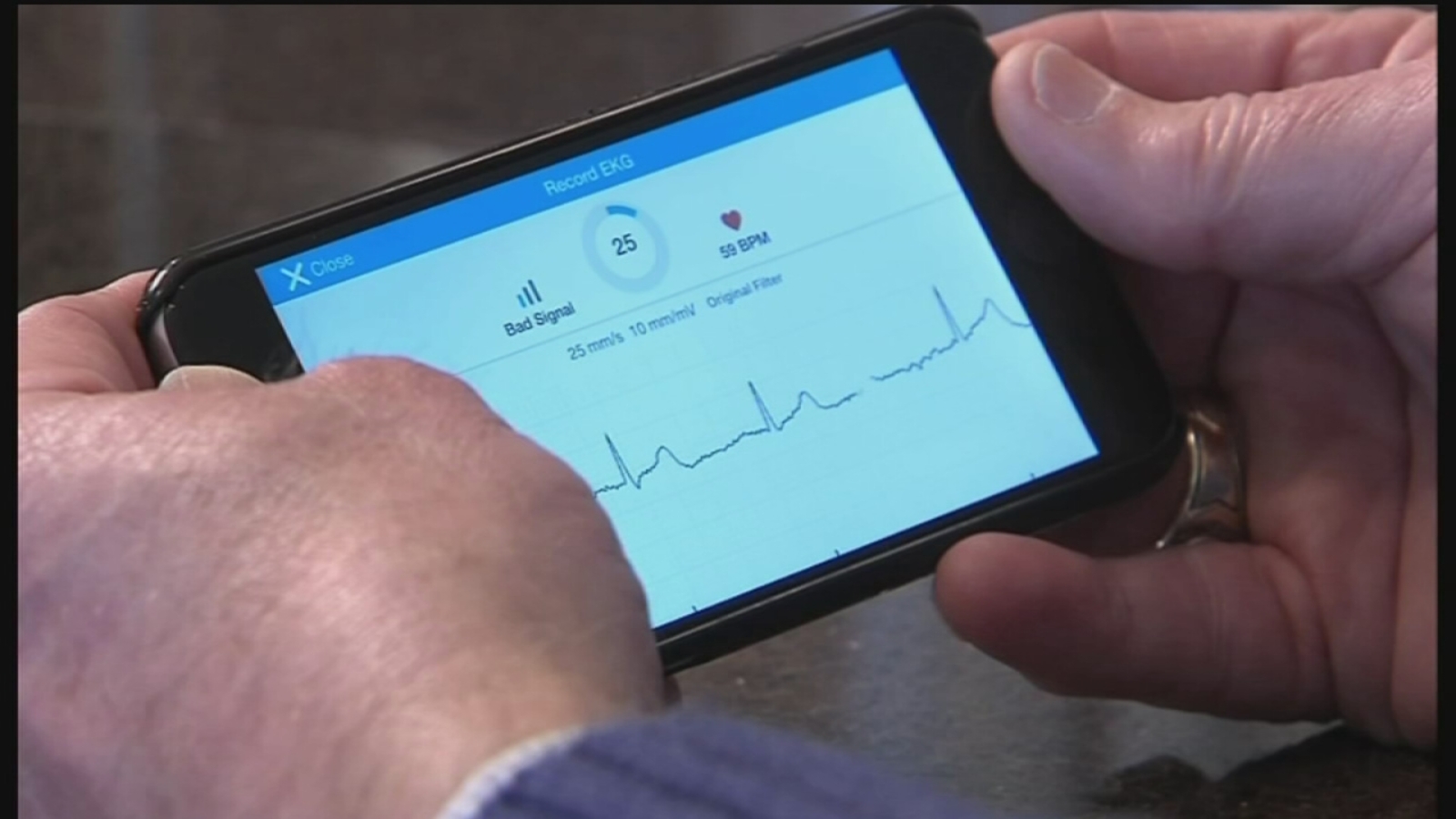 Mobile EKG monitor looks to help atrial fibrillation patients - 6abc ...