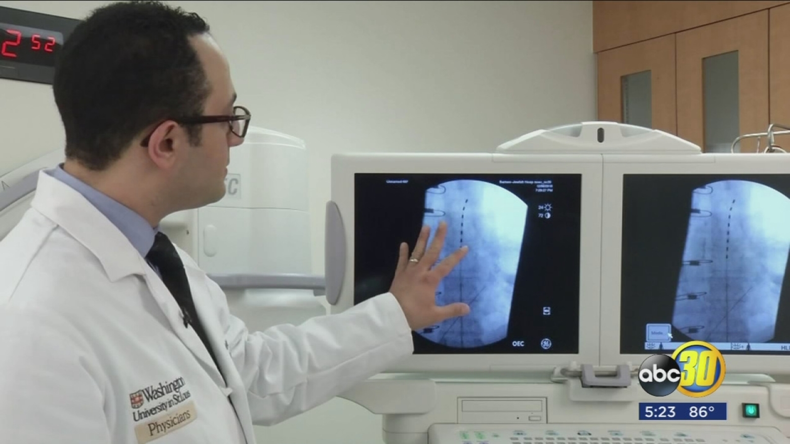 Spinal Stimulator: New and Approved - ABC30 Fresno