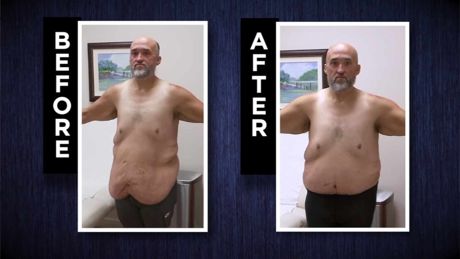Houstonian sheds massive amounts of skin to prove scales are no longer ...