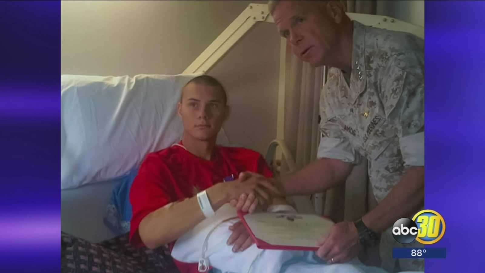 Nerve Transplant Saves a Soldier's Arm - ABC30 Fresno