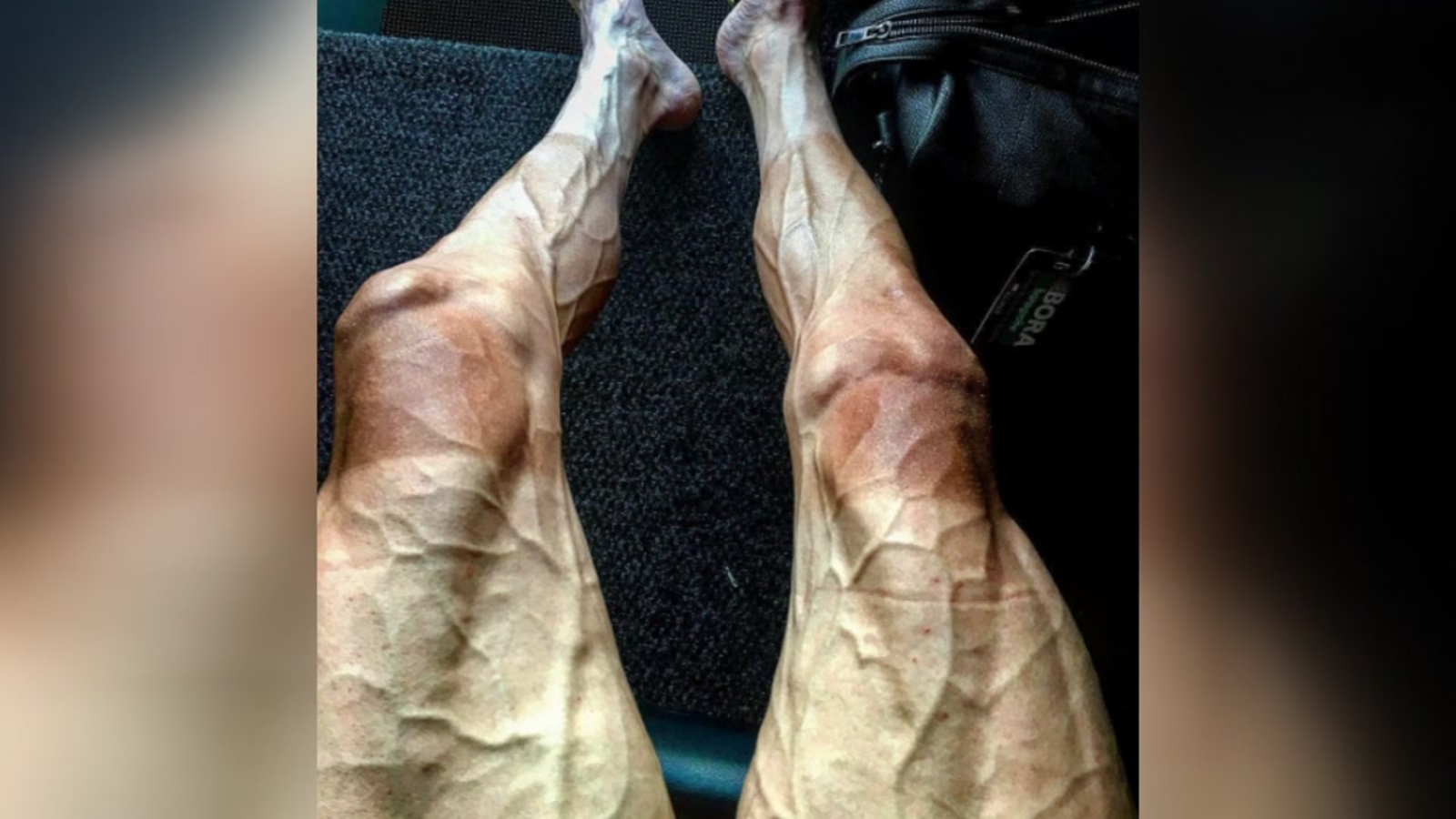 Photo of Polish cyclist's legs show physical effects of Tour de France ...