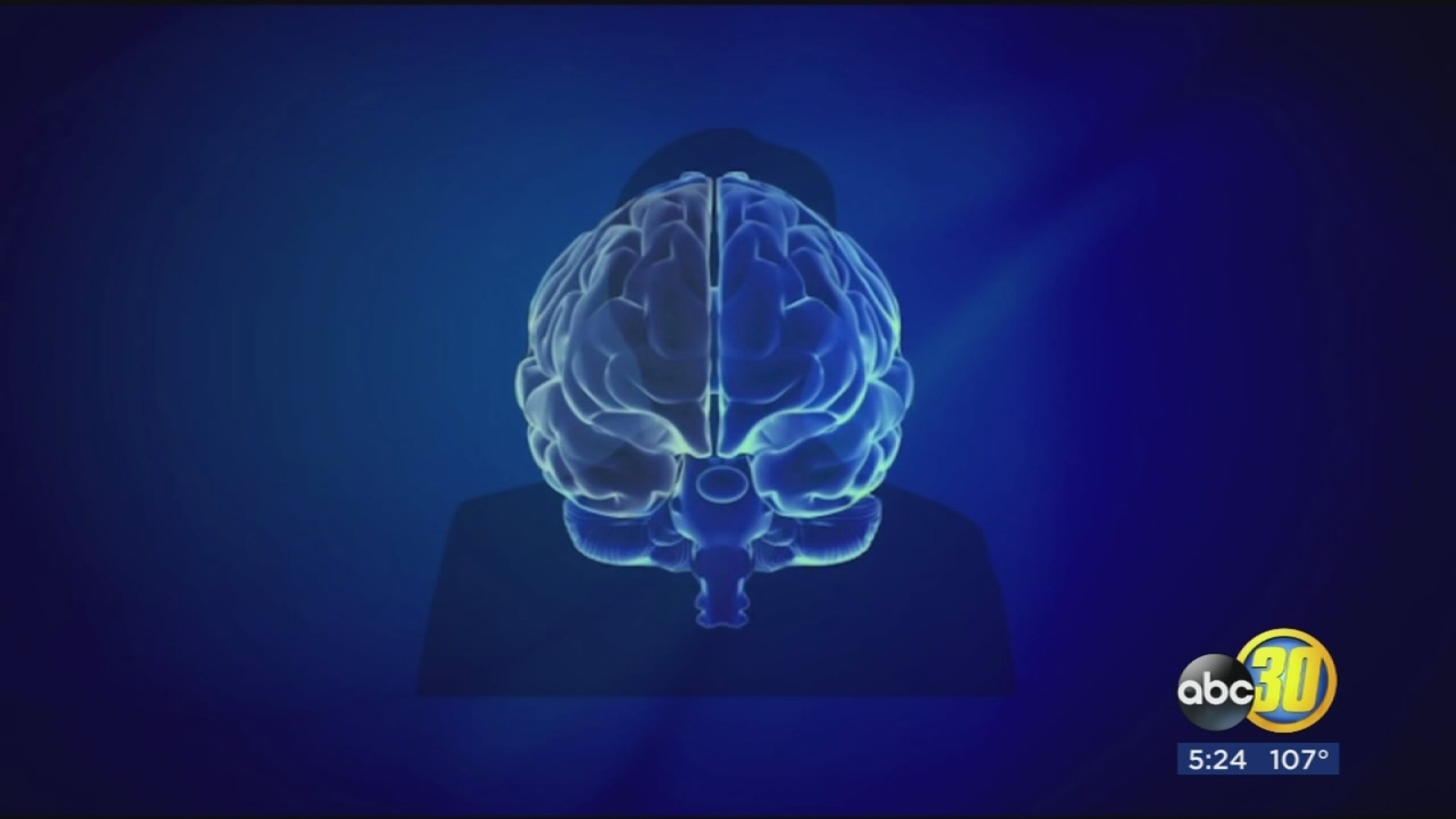 PNES Mimics Epilepsy - ABC30 Fresno