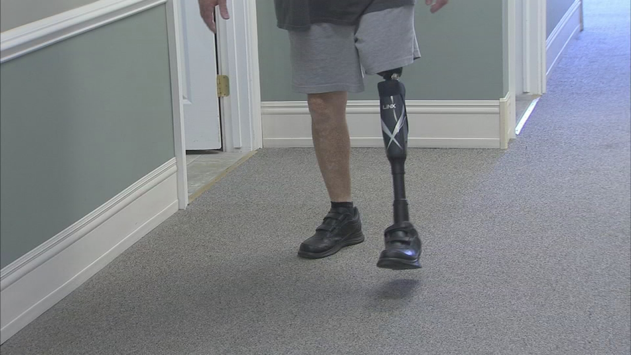 Bionic leg is giving amputees life changing help | 6abc.com