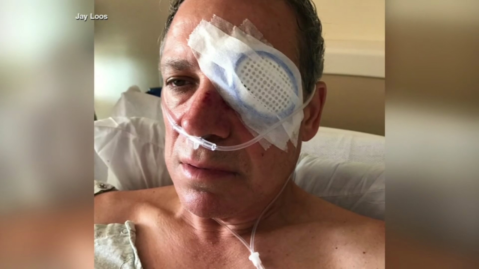 Man who says he was blinded in eye by foul ball sues Cubs - 6abc ...