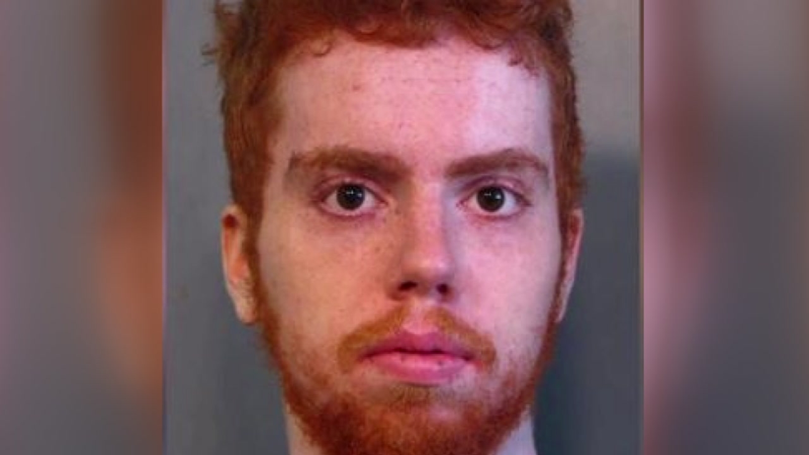 Man accused of biting out dog's eye - ABC13 Houston