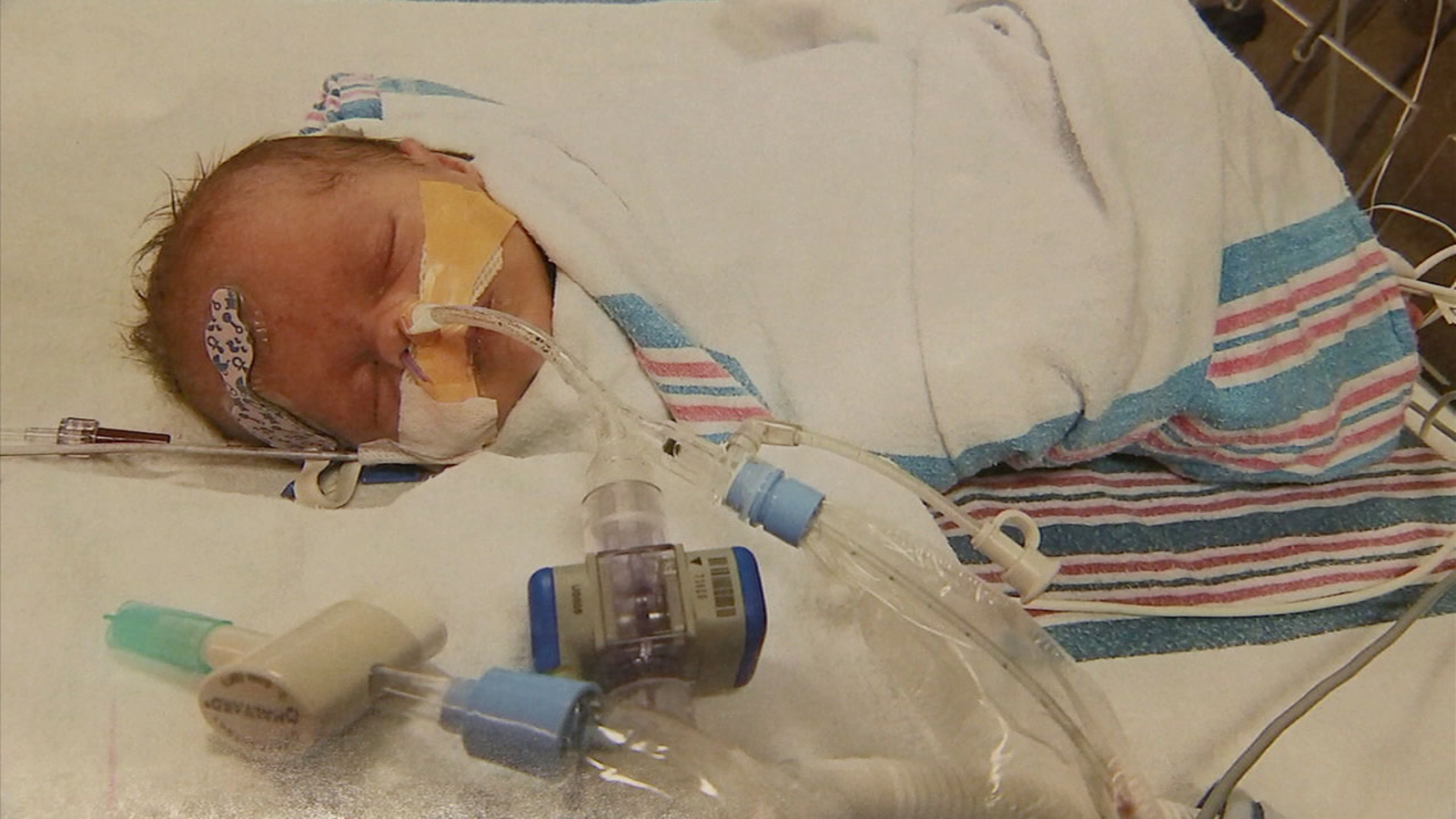 CHLA launches new stem cell trial for babies born with half a heart ...