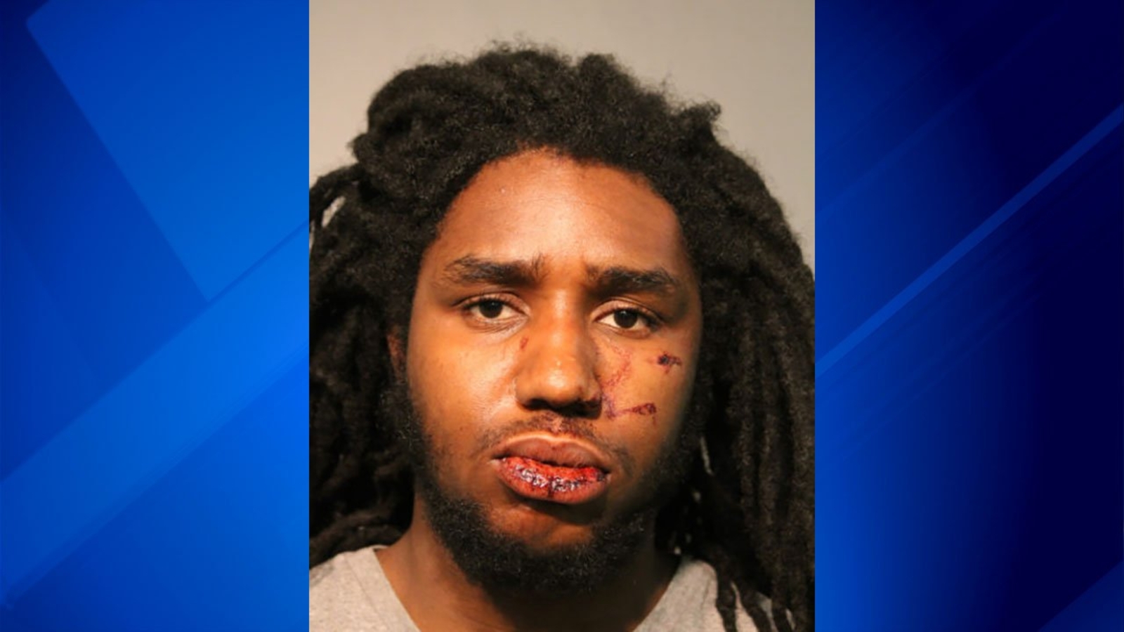 CTA conductor attacked on Red Line near Sheridan - ABC7 Chicago