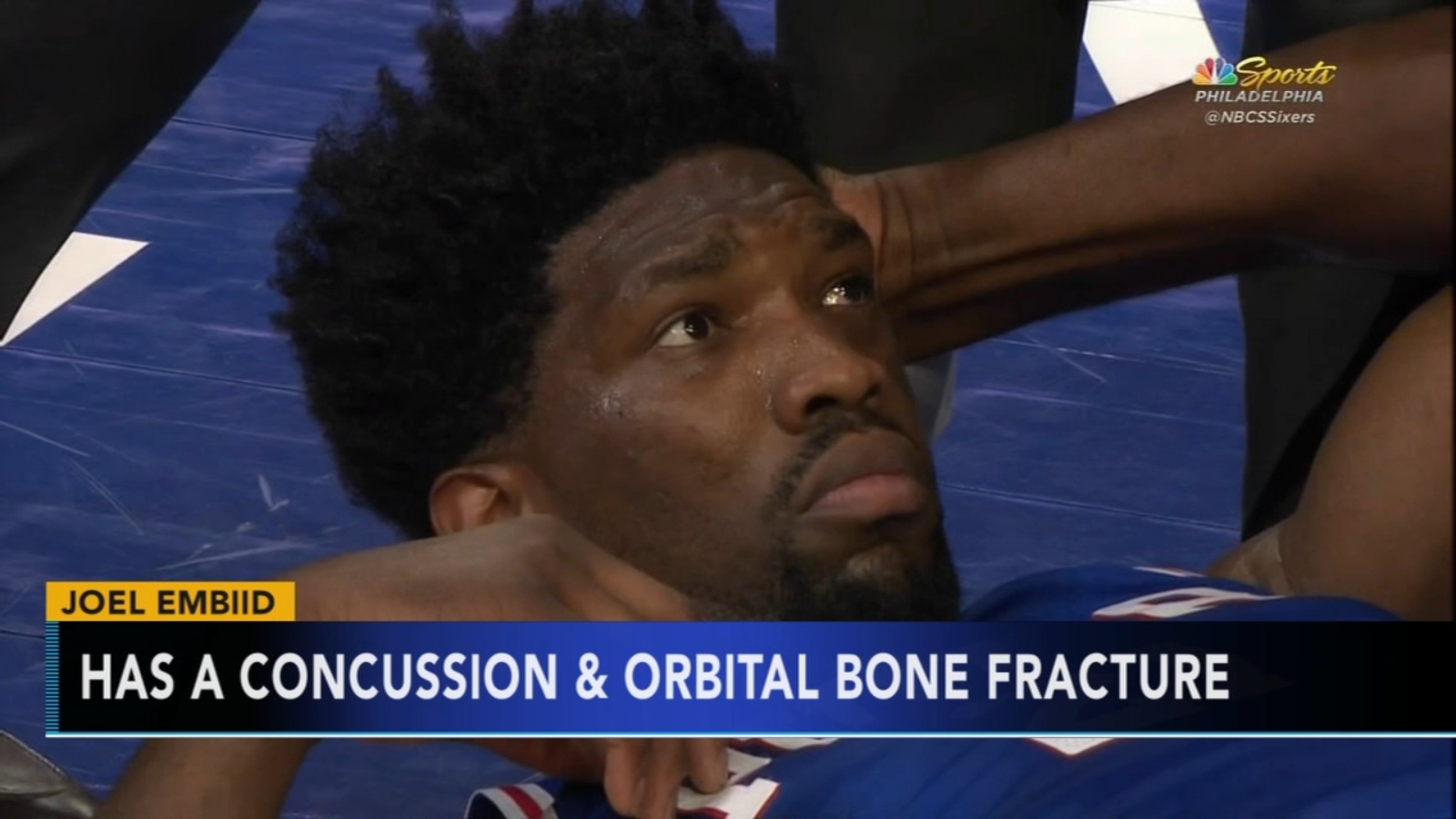 Sixers center Joel Embiid suffers concussion, orbital fracture - 6abc ...