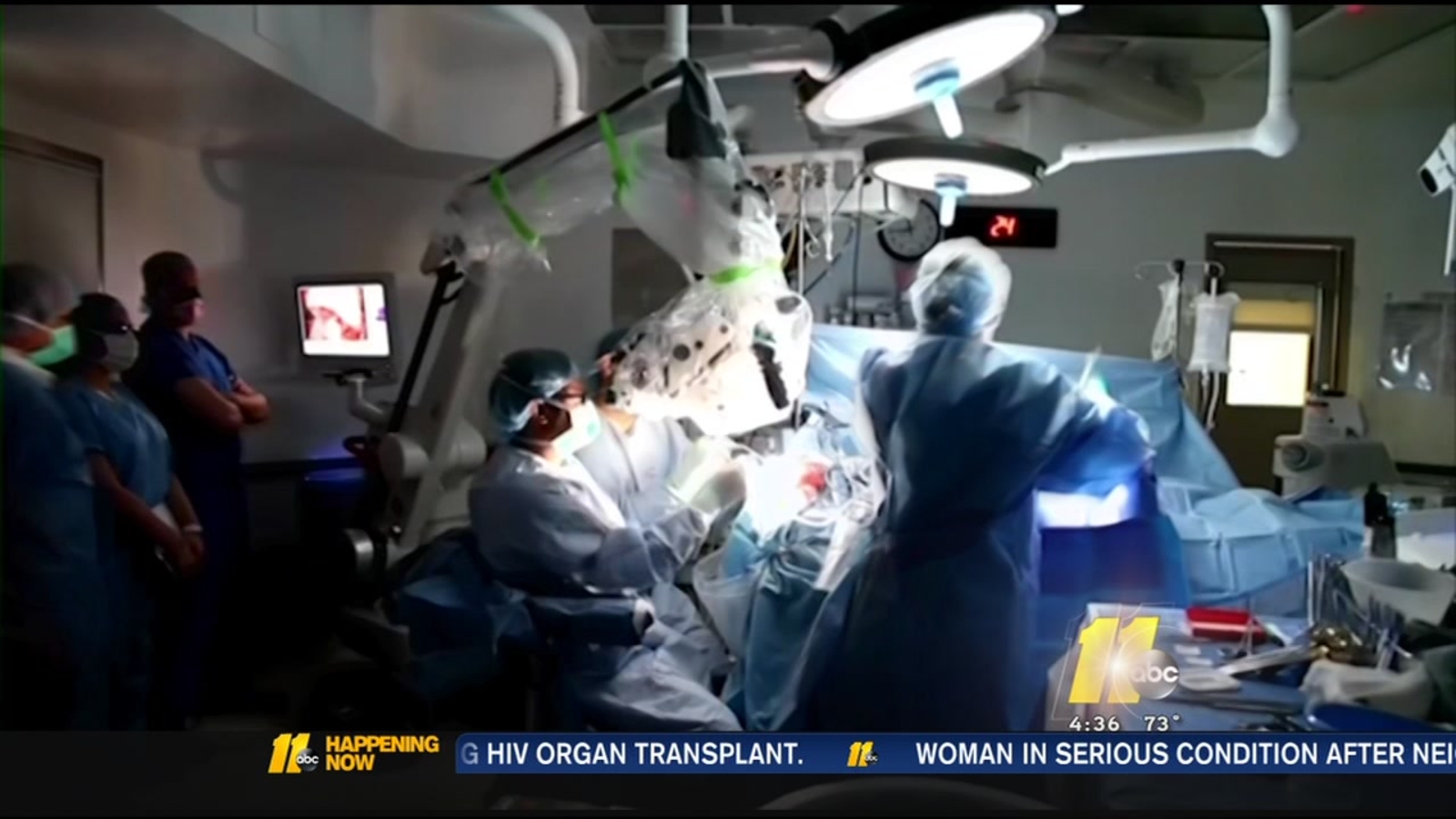 Duke surgeons perform groundbreaking HIV organ transplant - ABC11 ...