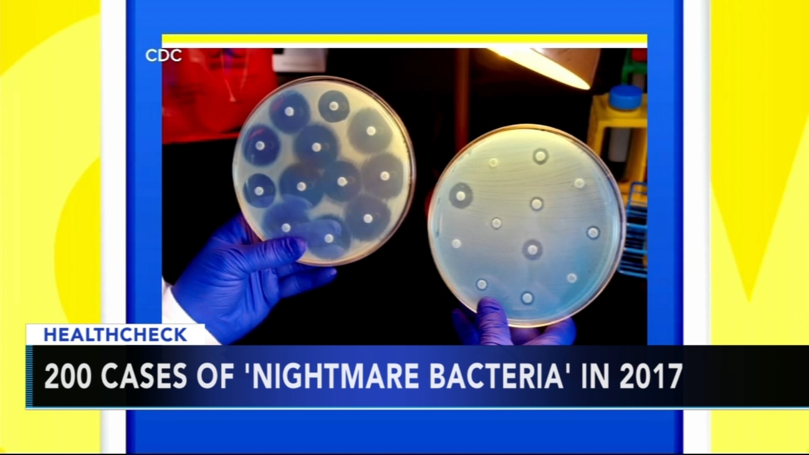 'Nightmare bacteria' found over 200 times in US last year - 6abc ...