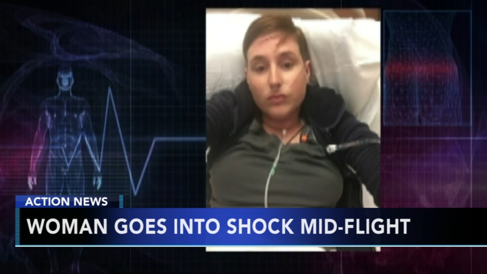 Woman goes into shock on flight from Philadelphia - 6abc Philadelphia