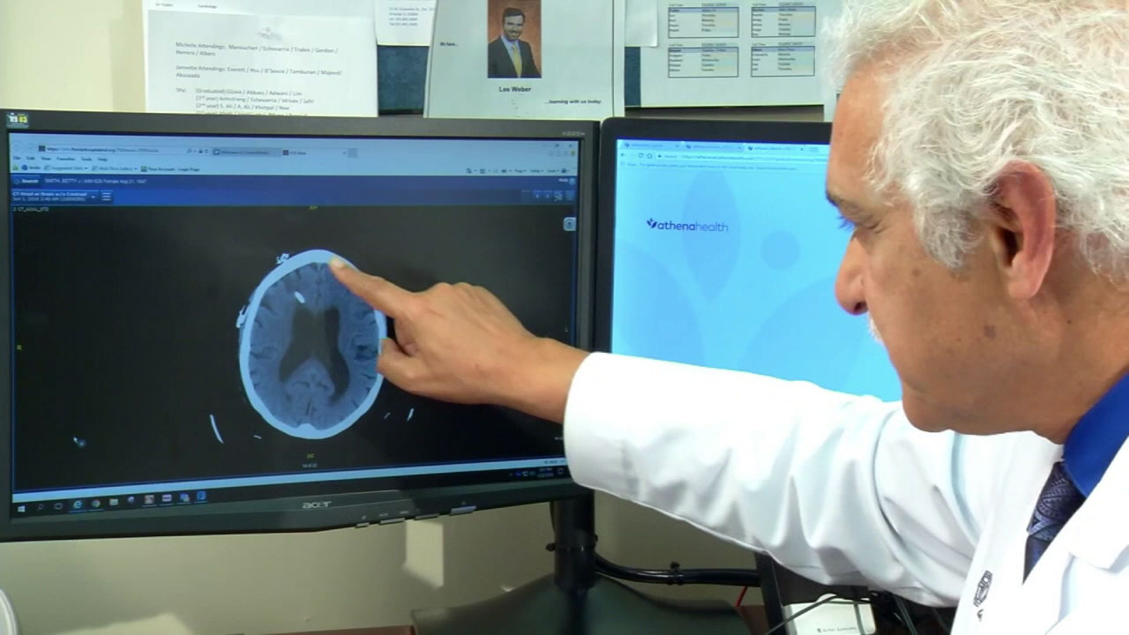 Lesser known NPH mimics Alzheimer's but is reversible - ABC7 Los Angeles