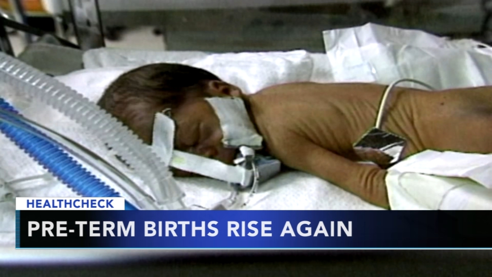 CDC: Pre-term births rise for third straight year - 6abc Philadelphia