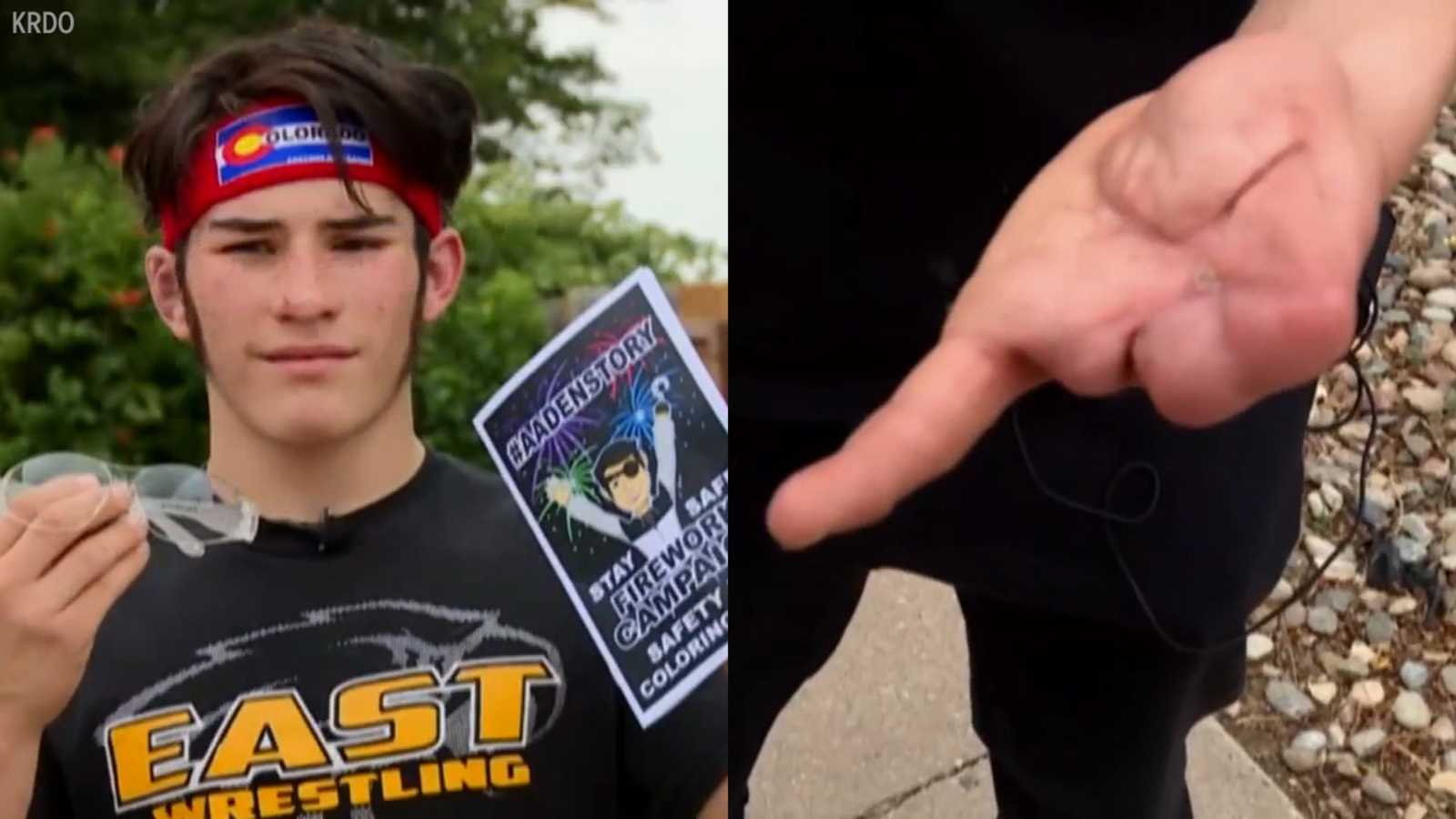 This teen is warning others about dangers of fireworks after losing his ...