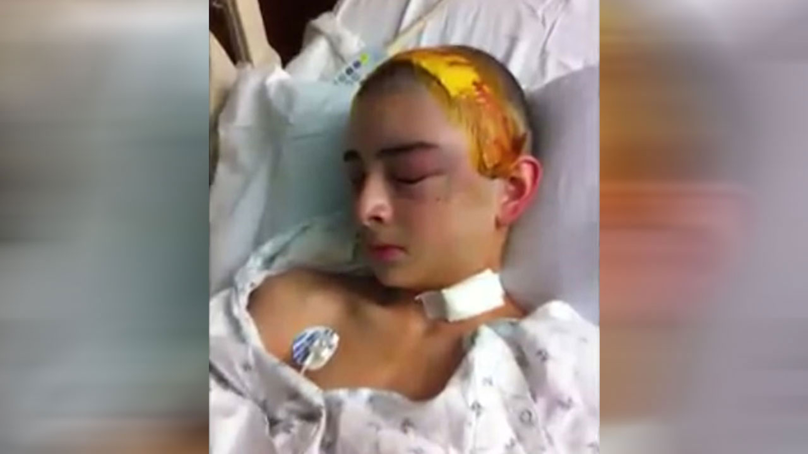 Florida man struck by celebratory gunfire outside theme park on the 4th ...