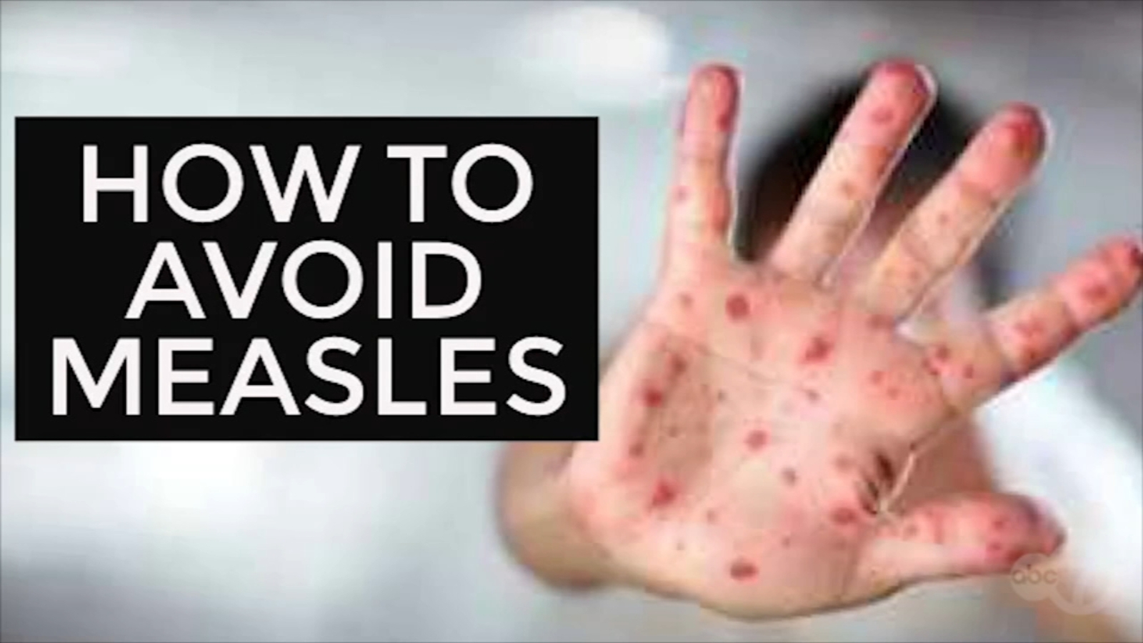 How to avoid measles - ABC13 Houston