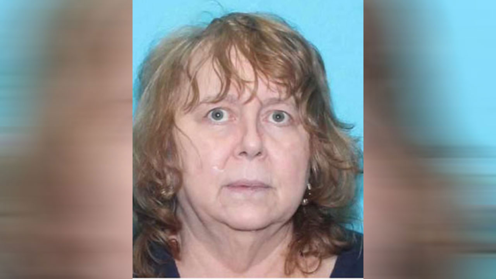 Catherine Czajkowski, a 66-year-old woman with medical condition ...