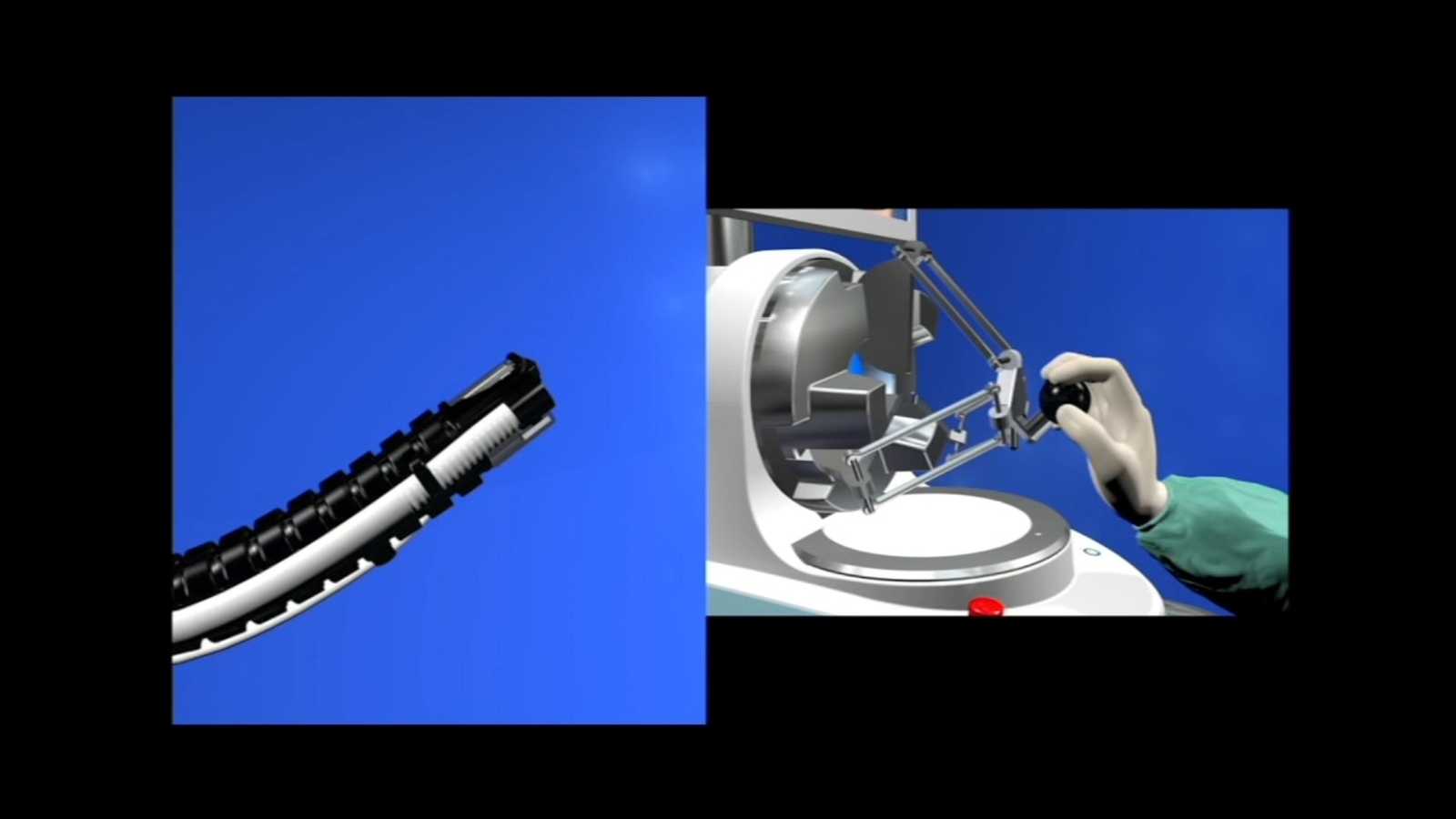 Robotic Snake Gobbles Tumors - ABC30 Fresno