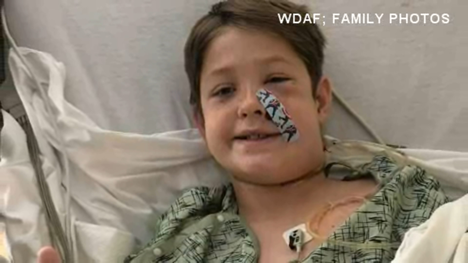 Boy miraculously survives after falling face first on meat skewer ...