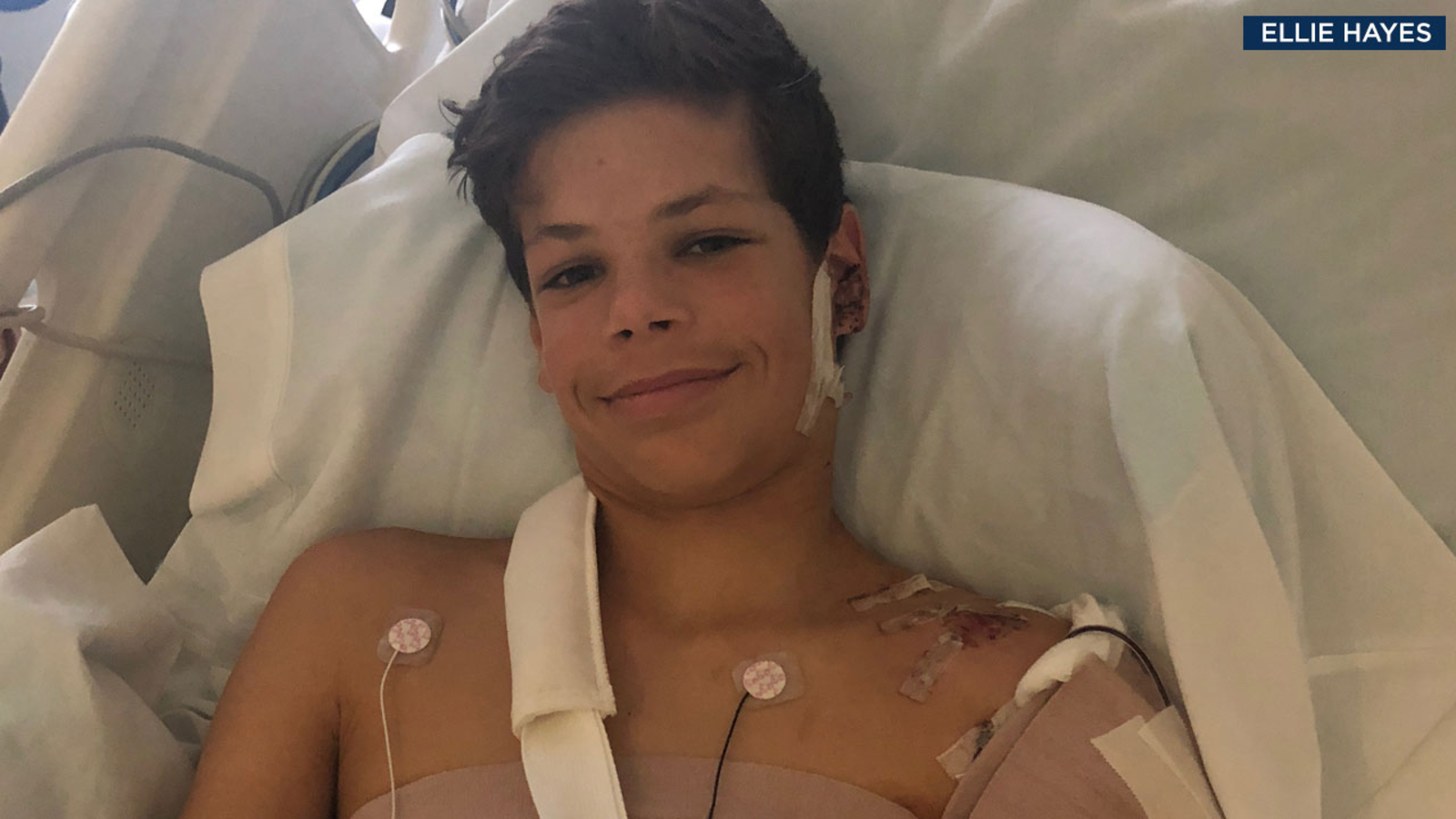 Encinitas Shark Attack 13 Year Old Victim Identified Will Make Full