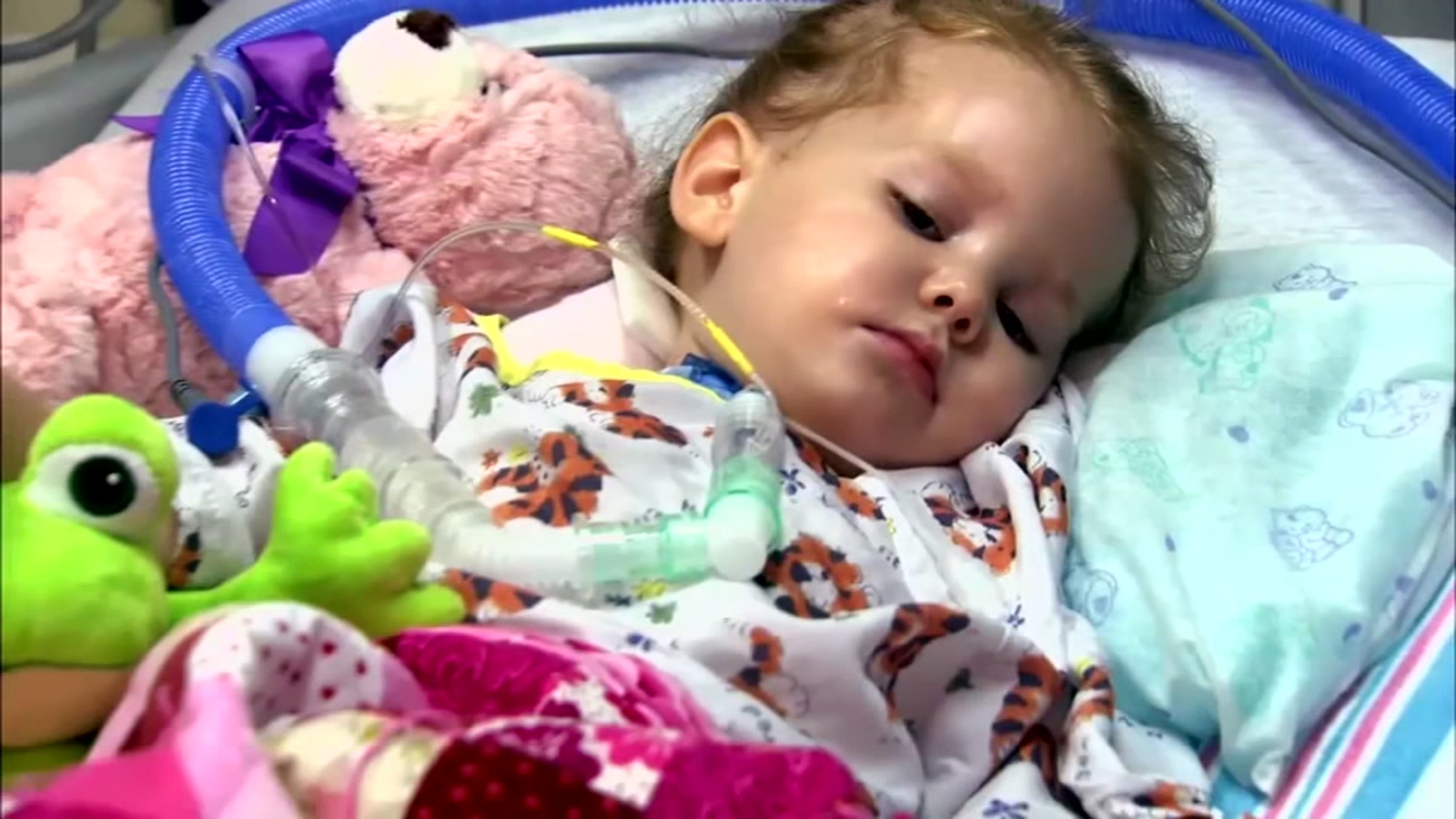 Acute flaccid myelitis: CDC says 155 cases of child paralysis under ...