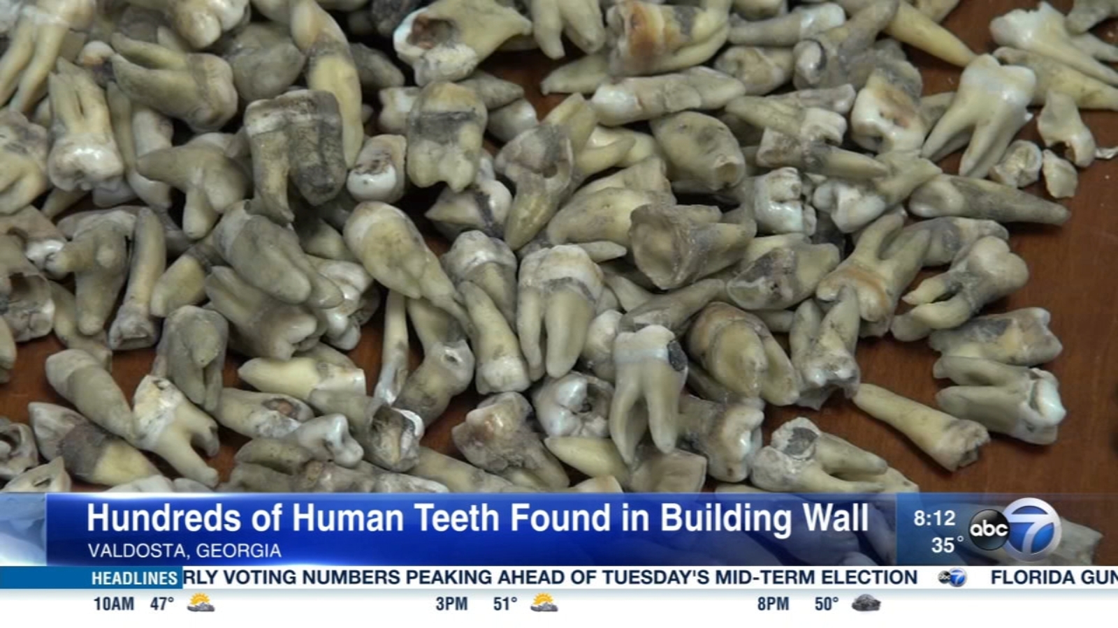 Nearly 1,000 human teeth found in walls of building - ABC7 Chicago