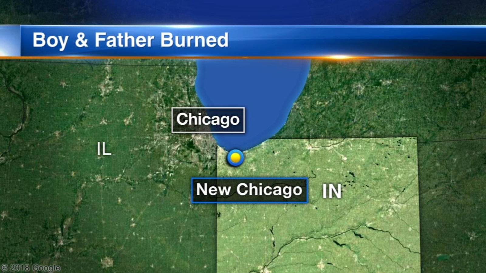 NW Indiana boy, 7, burned after pouring gas on outdoor fire - ABC7 Chicago