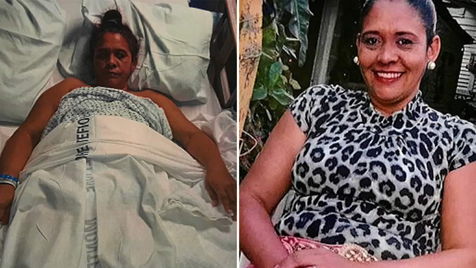 Innocent woman injured by police bullet in Bronx speaks out - ABC7 New York