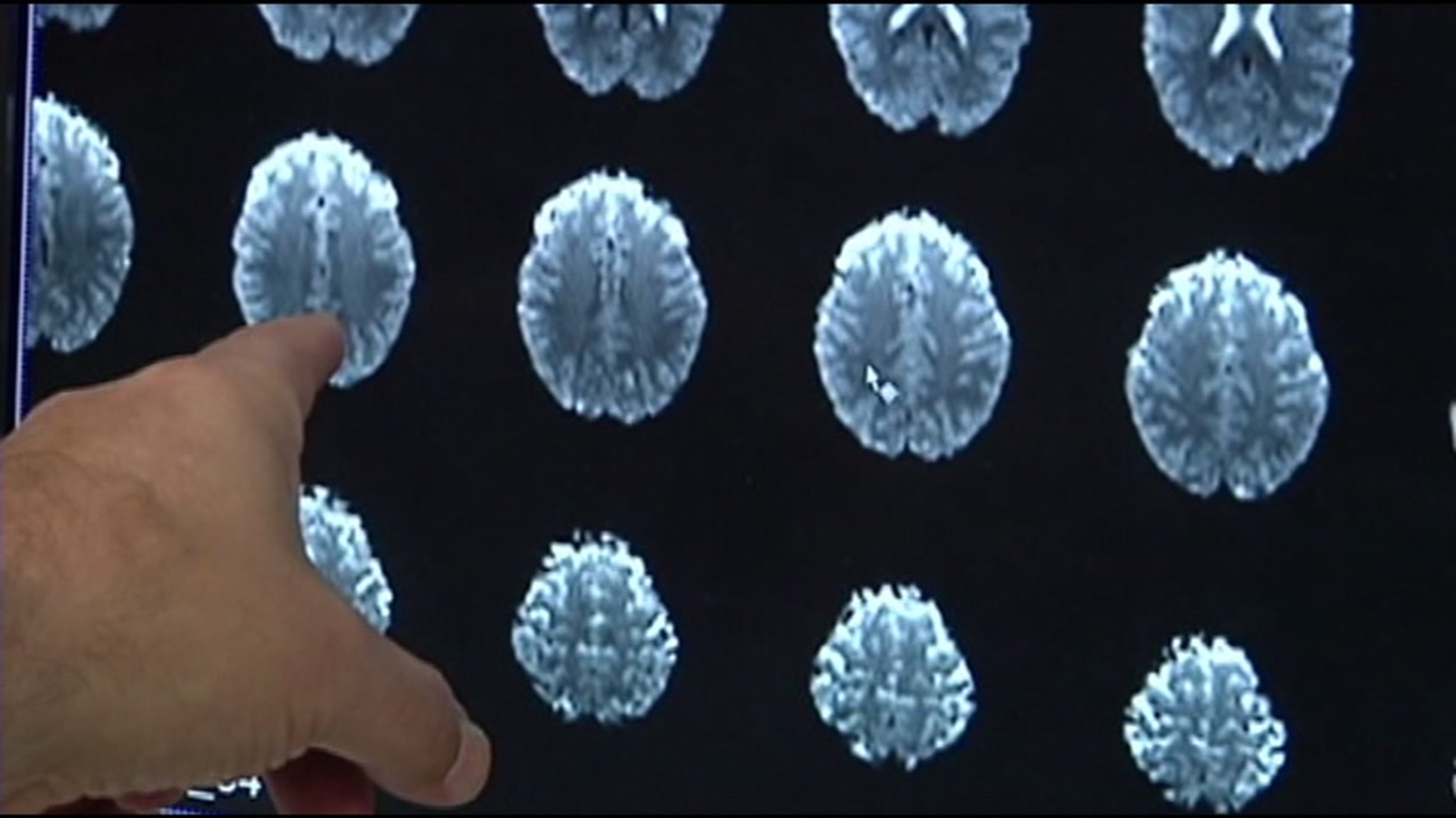 UCSF scientists create decoder to translate brain signals to speech ...