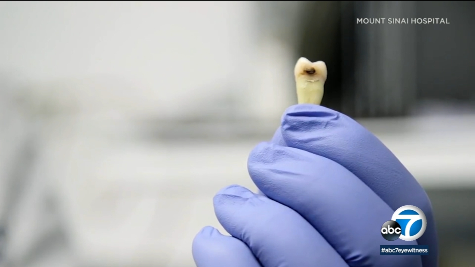 Lead found in baby teeth of kids living near former battery recycling ...