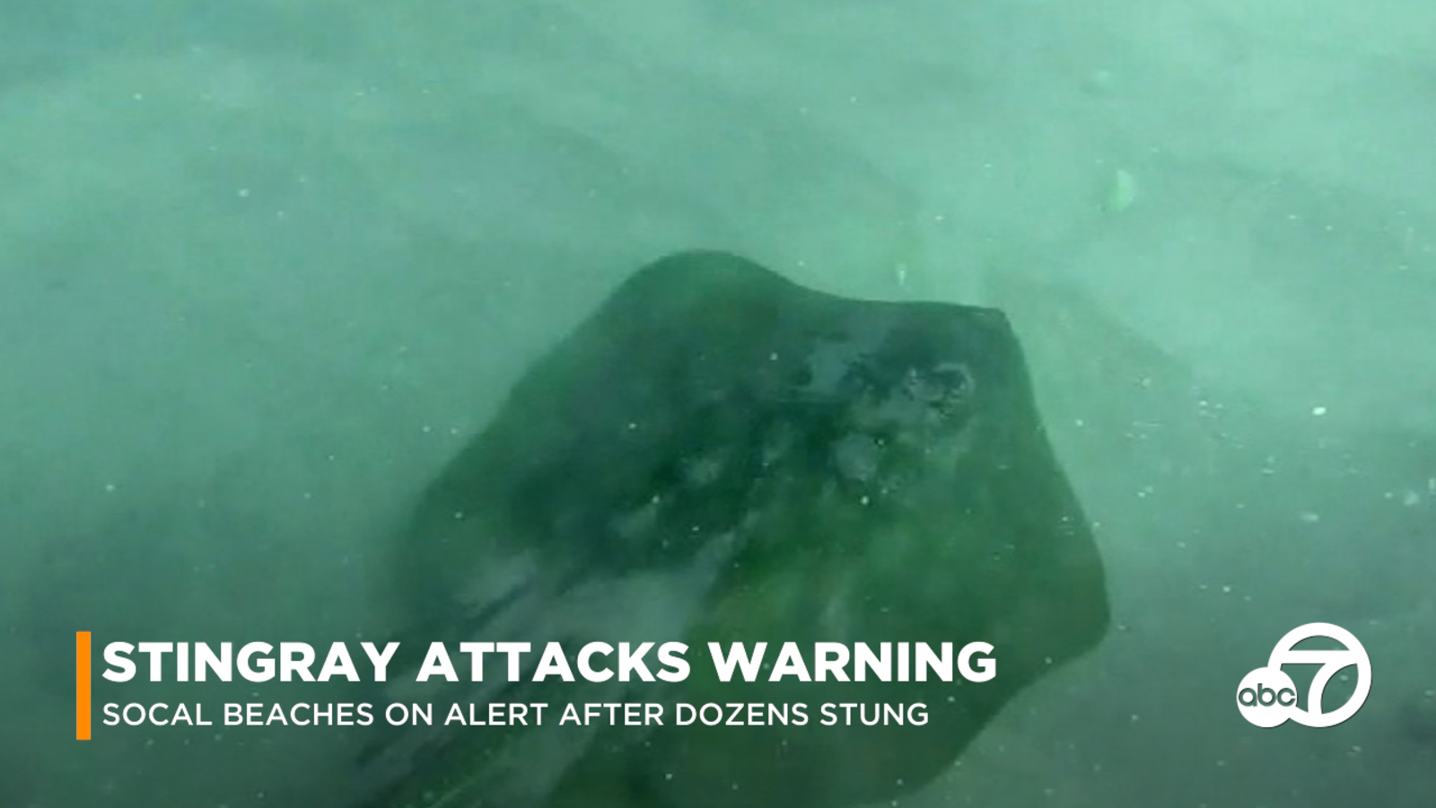 Eyewitness This: Multiple SoCal beachgoers stung by stingrays - ABC7 ...